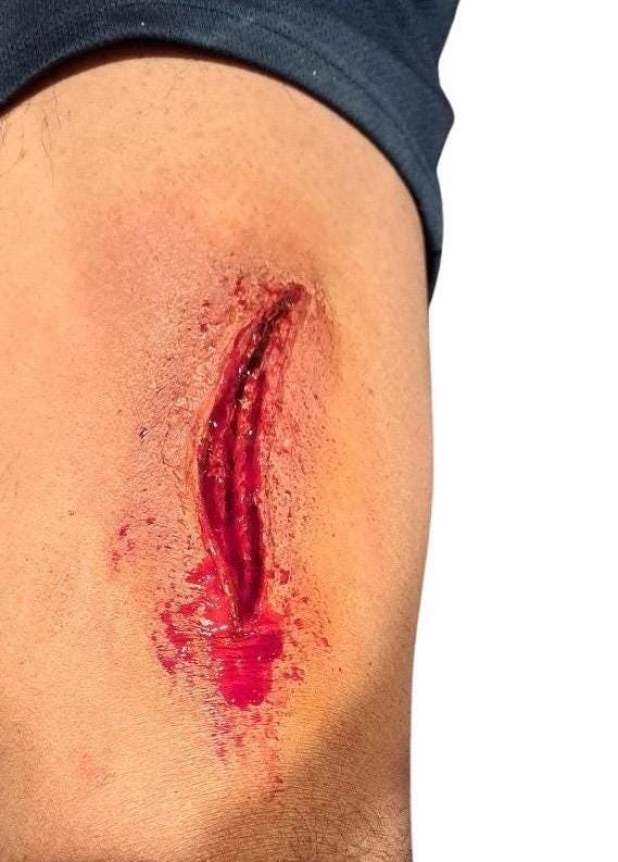Realistic Latex Prosthetic Wound - Fresh Gash, Injury - Special Effect ...